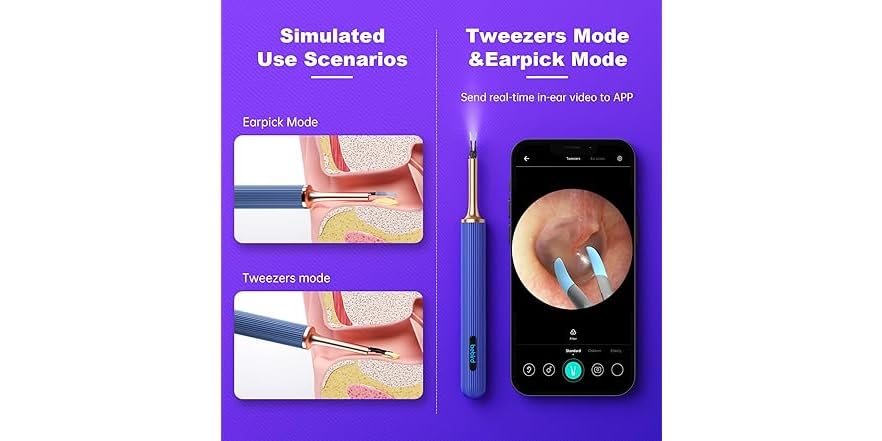 BEBIRD Note3 Pro Max Ultimate Version