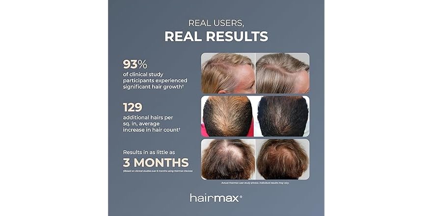 Hairmax HAIRMAX LASER BAND 82 Hairmax Hair Growth Laser B (Open Box)