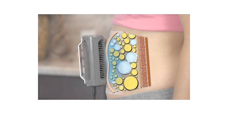 Shape-N-Freeze Body Sculpt Fat Freezer