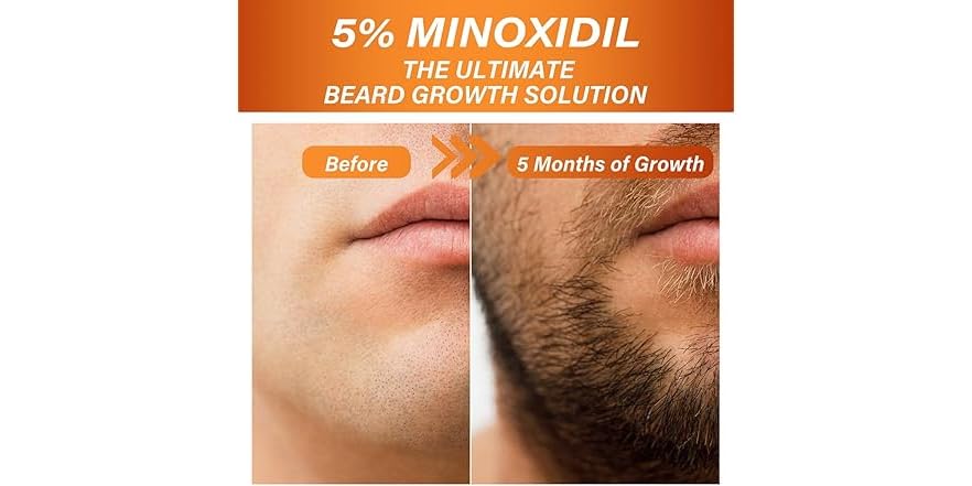 Appolina Beard Growth Serum for Men