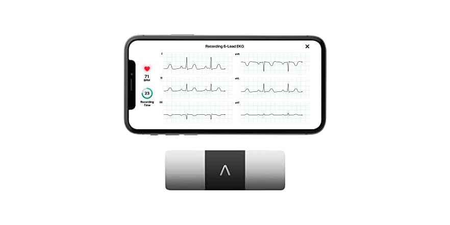 KardiaMobile 6-Lead Personal EKG Monitor