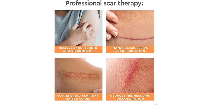 Strataderm Professional Scar Therapy Gel 5g (0.17oz)