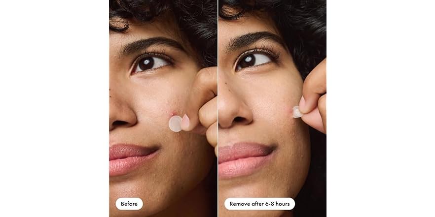 3PK Mighty Patch™ Invisible+ Pimple Patch (72 Count)