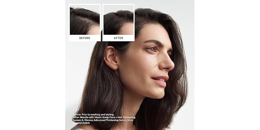 Nioxin Scalp + Hair Thickening System 3