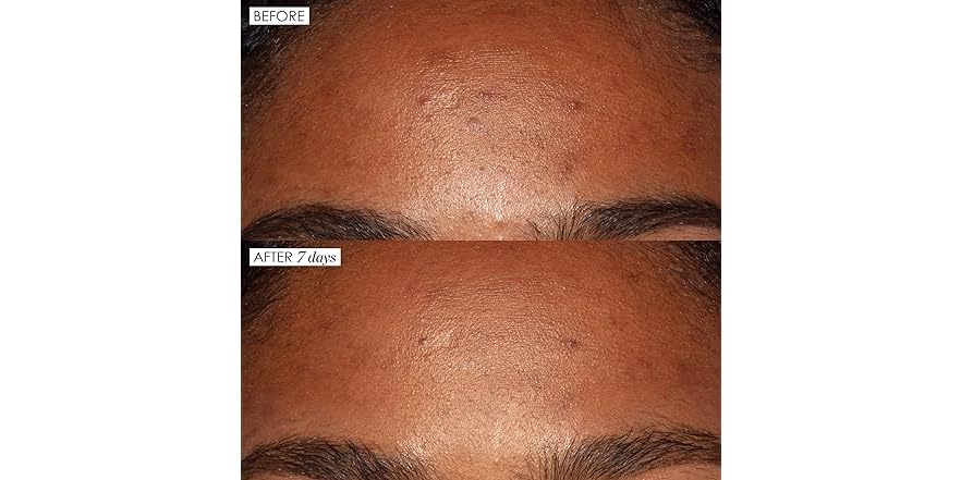 Sunday Riley Good Genes All-in-One Lactic Acid Treatment Face Serum