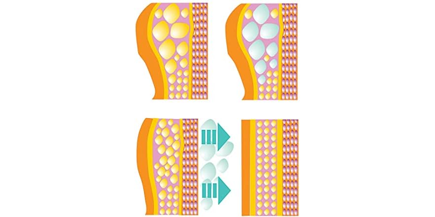 BEAUTYKO Ultimate Fat Freezer