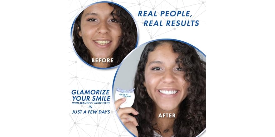 Gleam&Glam TEETHKIT Teeth Whitening Kit