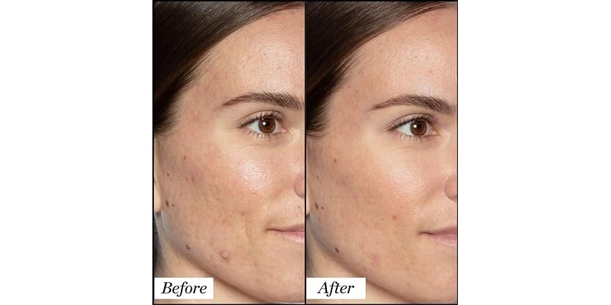 Sunday Riley Good Genes All-in-One Lactic Acid Treatment Face Serum