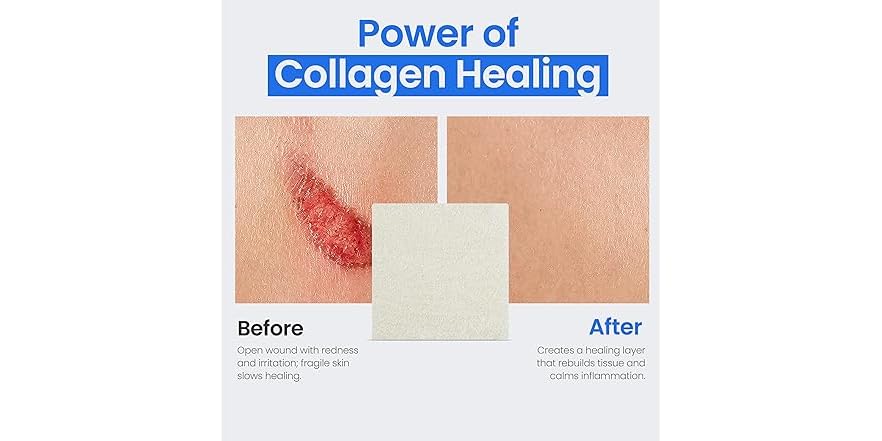 Simpurity Collagen Pads 5ct