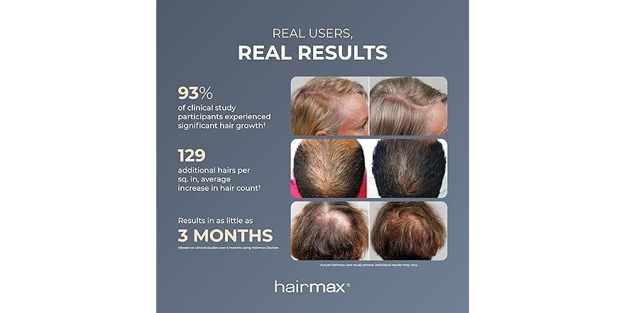 HairMax ULTIMA 12 LaserComb (Open Box)