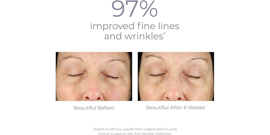 DERMA-E Anti-Wrinkle Renewal Skin Cream