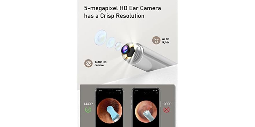 Bebird Pro Ear Wax Removal Tool, White