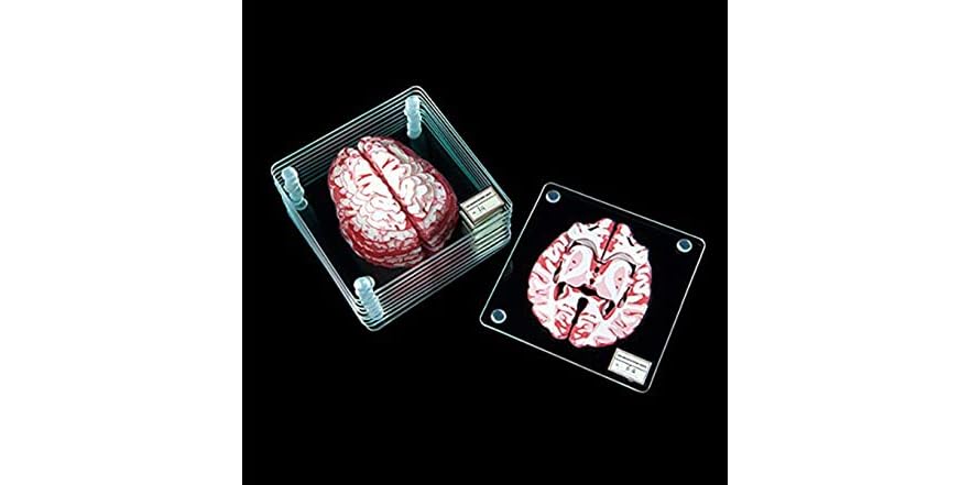 Brain Specimen Glass Coasters