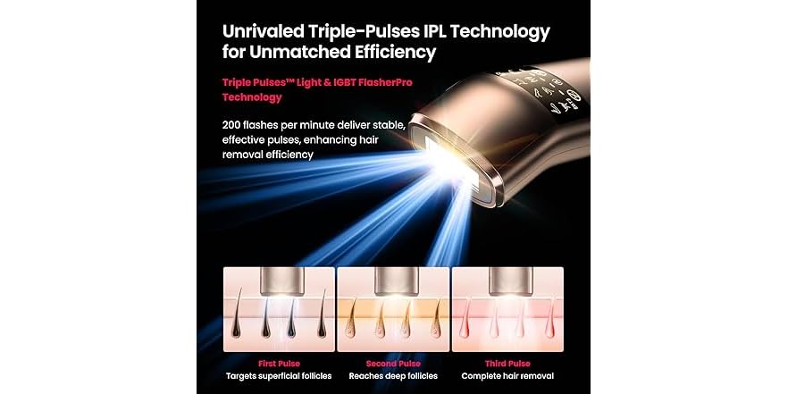 TRIPLE-Pulse IPL Laser Hair Removal
