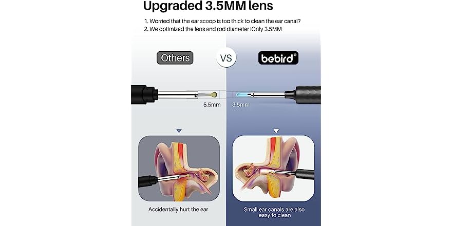 BEBIRD X3 Ear Wax Camera