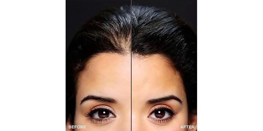 Toppik Hairline Optimizer, 5 Pack