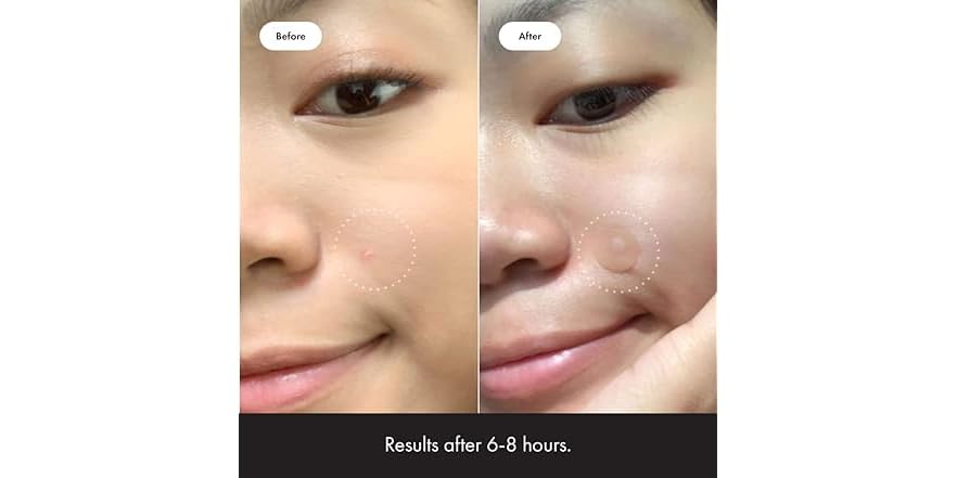 (3 Pack) Mighty Patch™ Original Patch from Hero Cosmetics