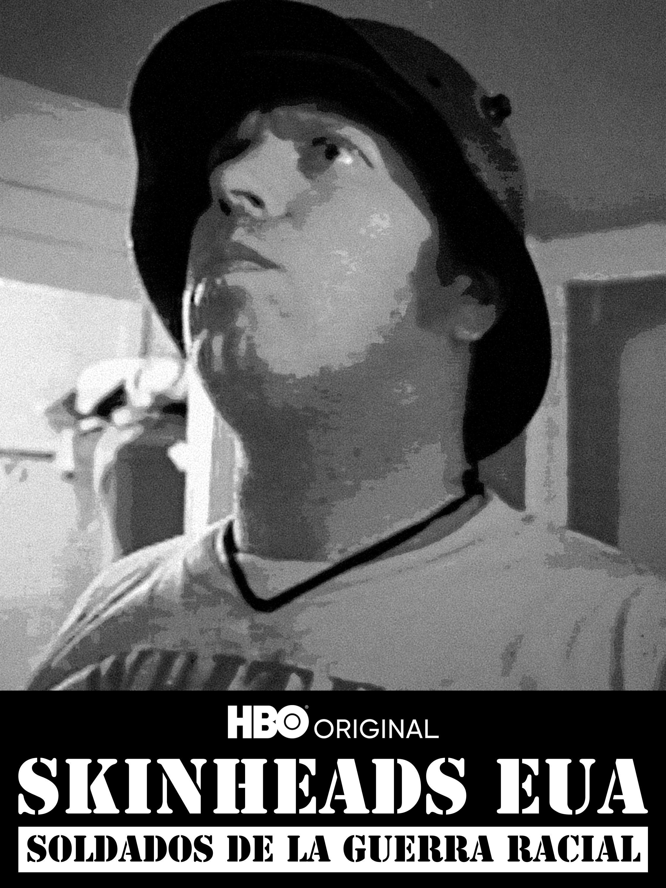 Skinhead Frontal Americano