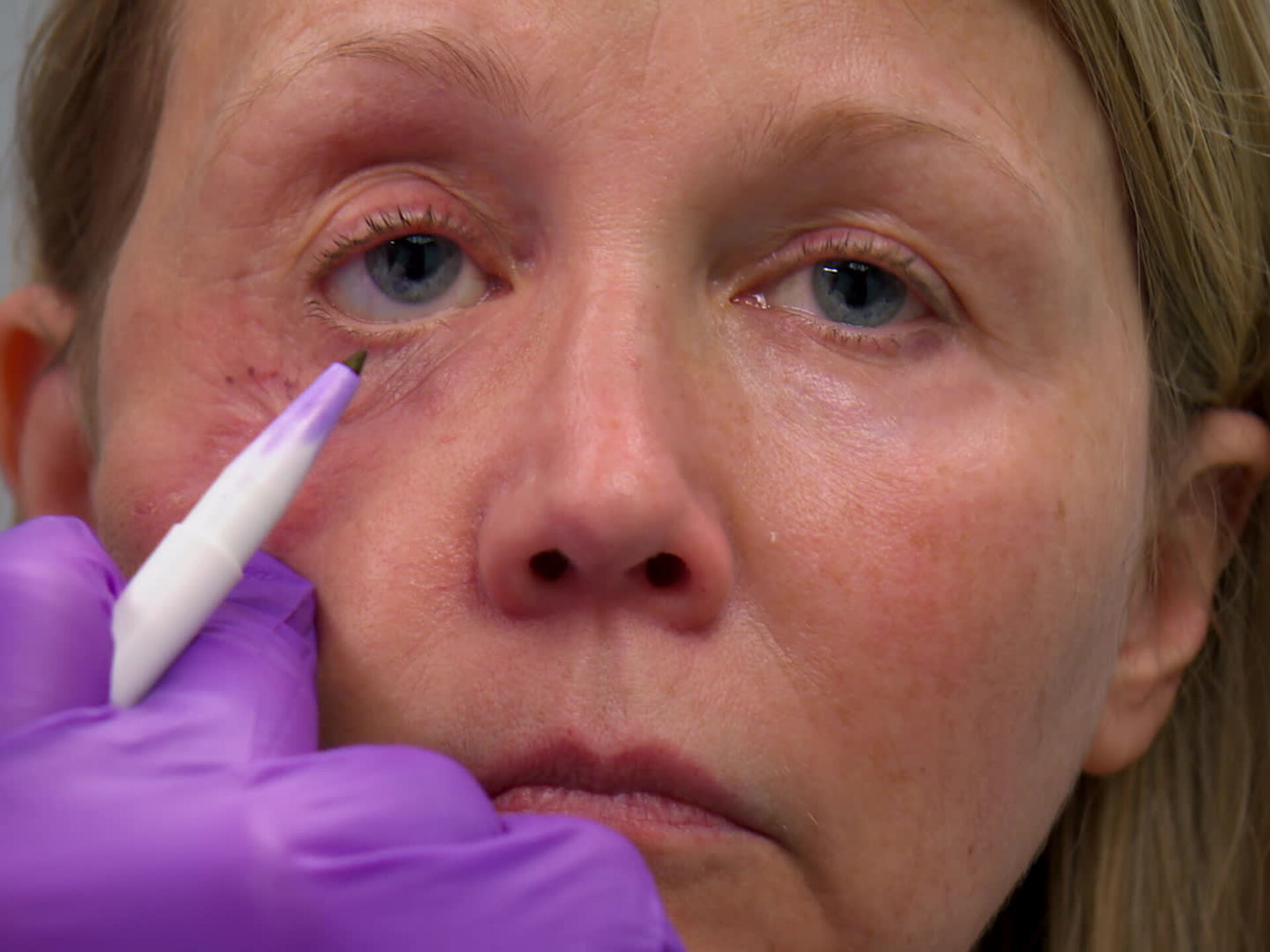 Prime Video: Botched - Season 7