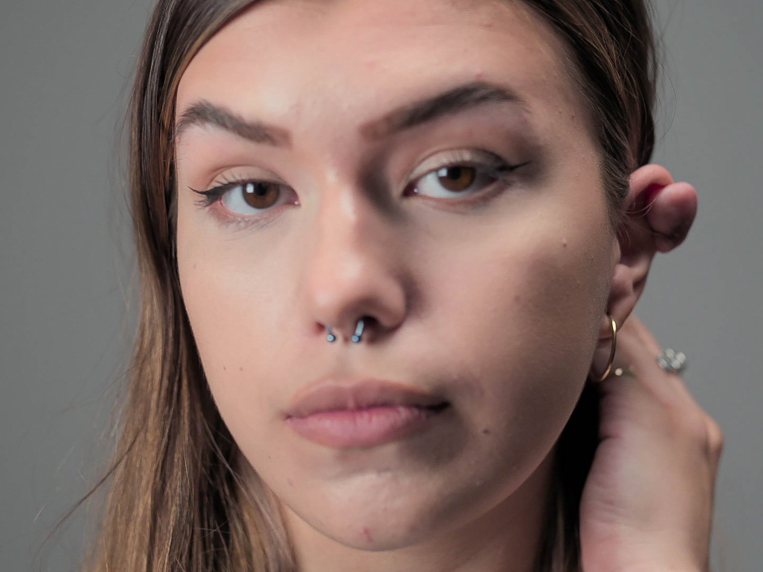 Prime Video: The Bad Skin Clinic - Season 3