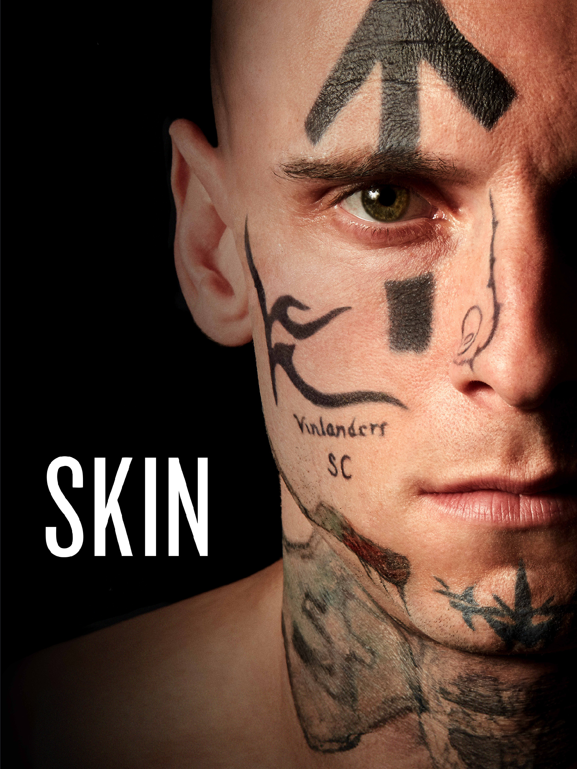 Prime Video: Skin