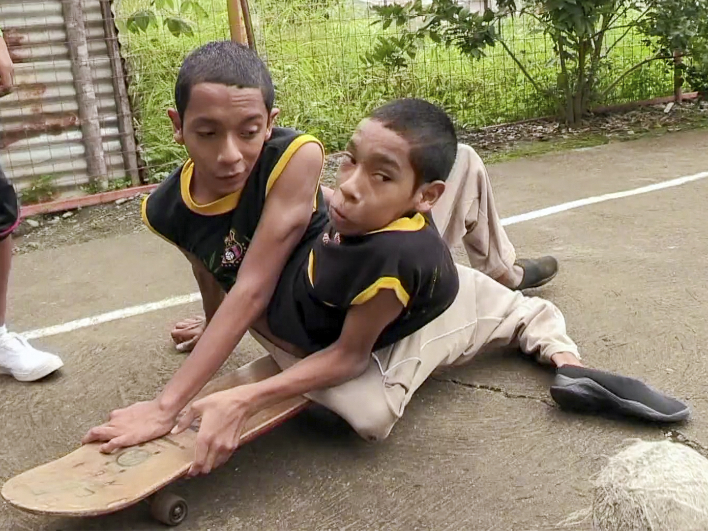 Prime Video: Body Bizarre - Season 1