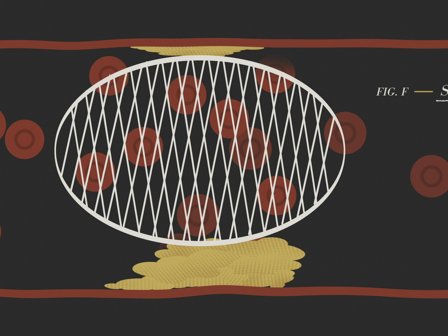 Prime Video: Sick - Season 1