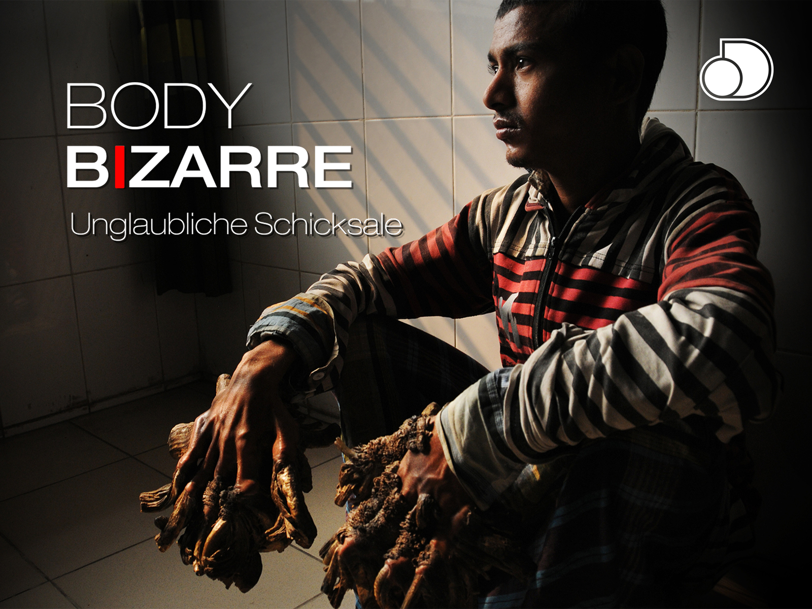 Prime Video: Body Bizarre - Unglaubliche Schicksale - Season 4