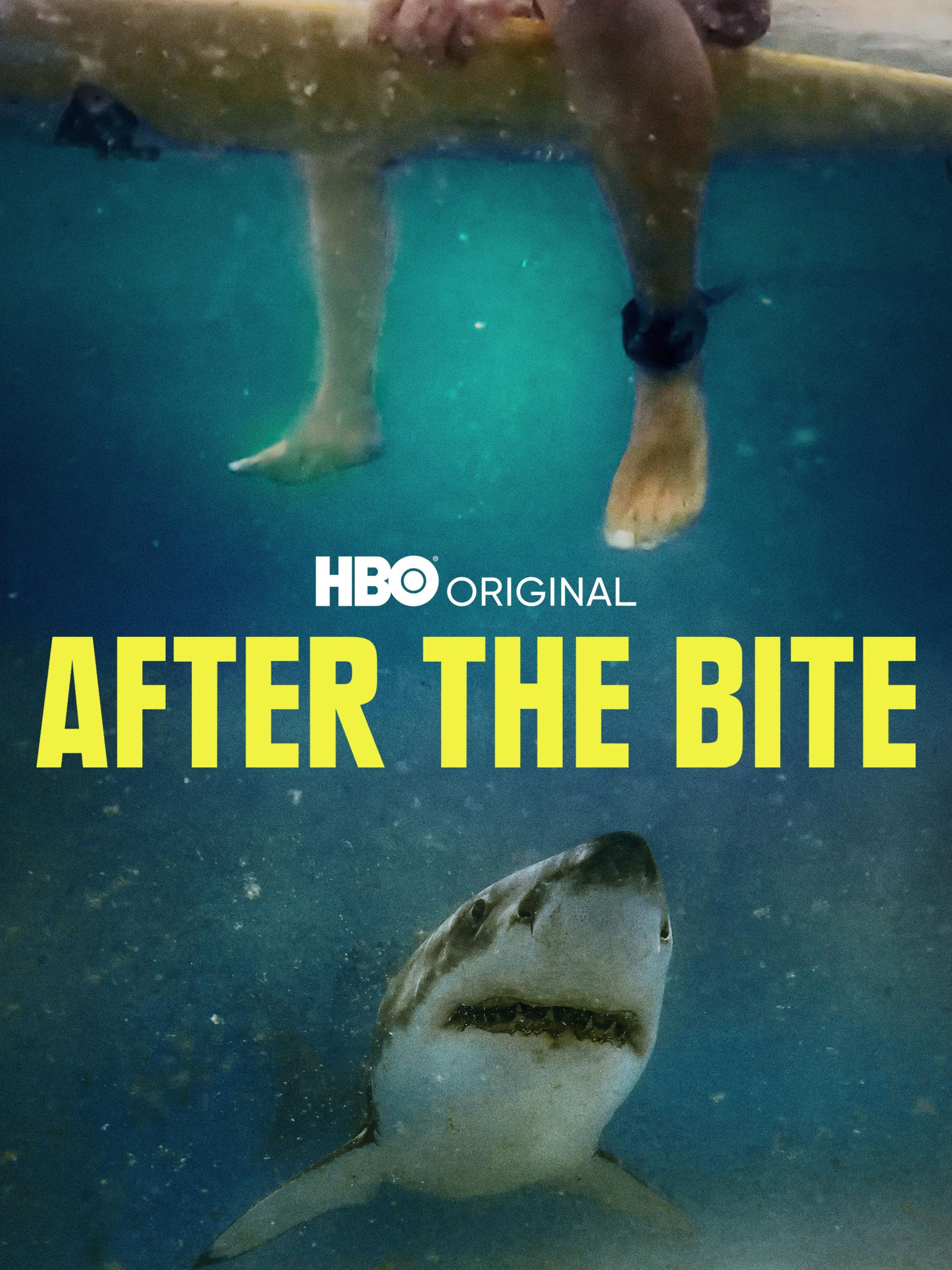 Prime Video: After the Bite