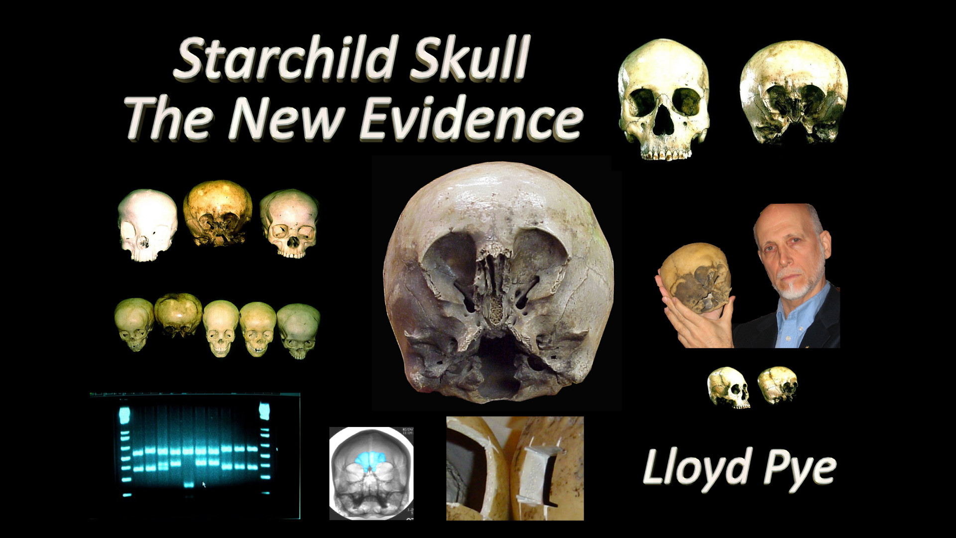 Watch Starchild Skull - The New Evidence | Prime Video
