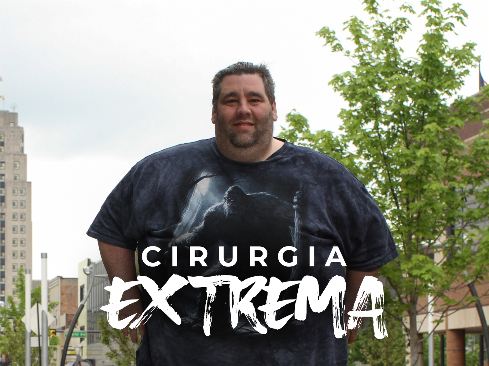 Prime Video: The Man With The 80lb Groin - Season 1