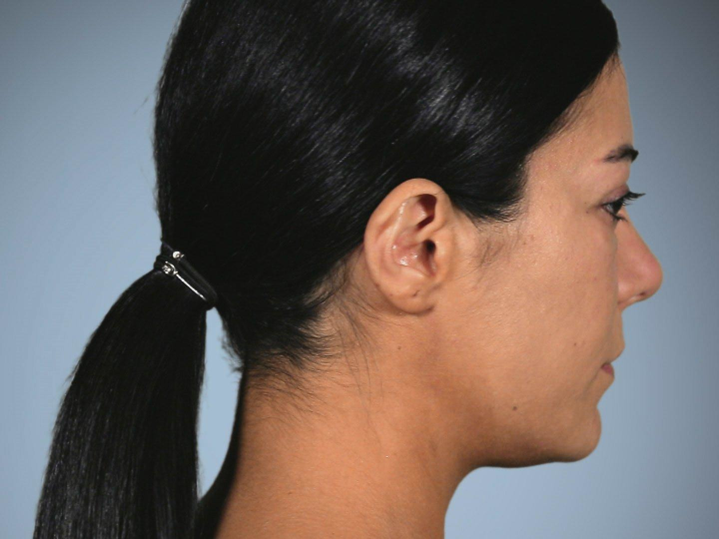 Prime Video: Botched Season 5