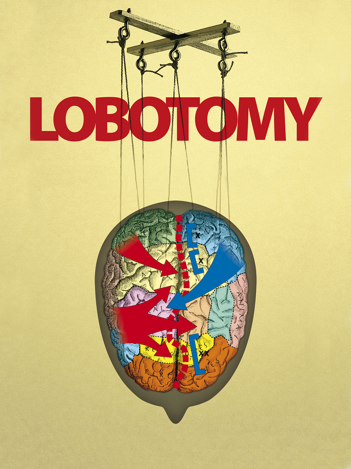 Prime Video: Lobotomy
