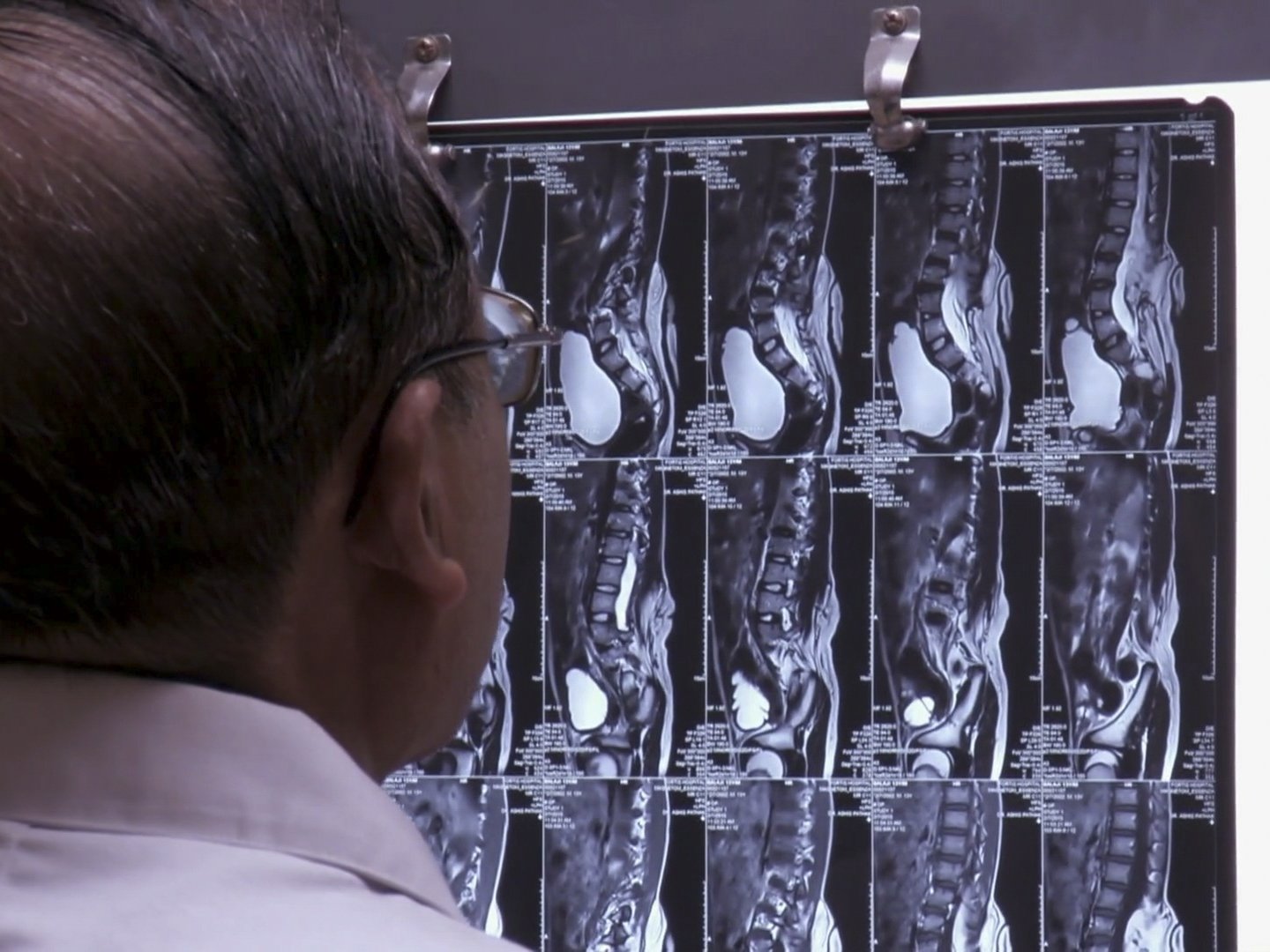 Prime Video: Body Bizarre - Season 2