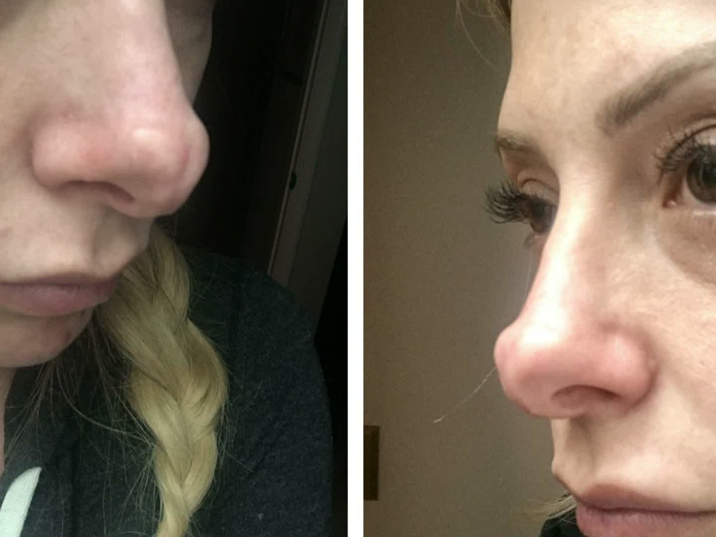 Prime Video: Botched Season 5