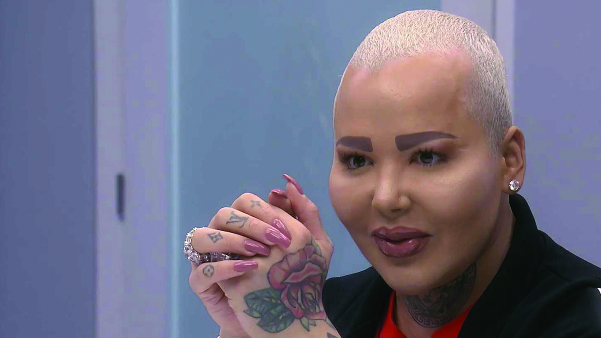 Watch Botched Season 5 | Prime Video