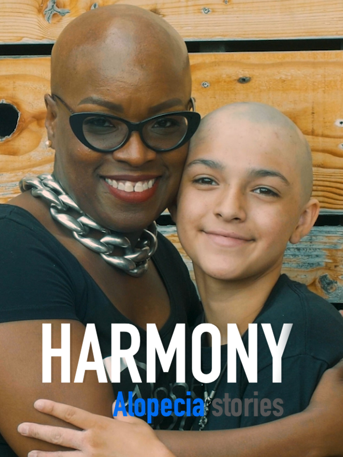 Prime Video: Harmony: Alopecia Stories