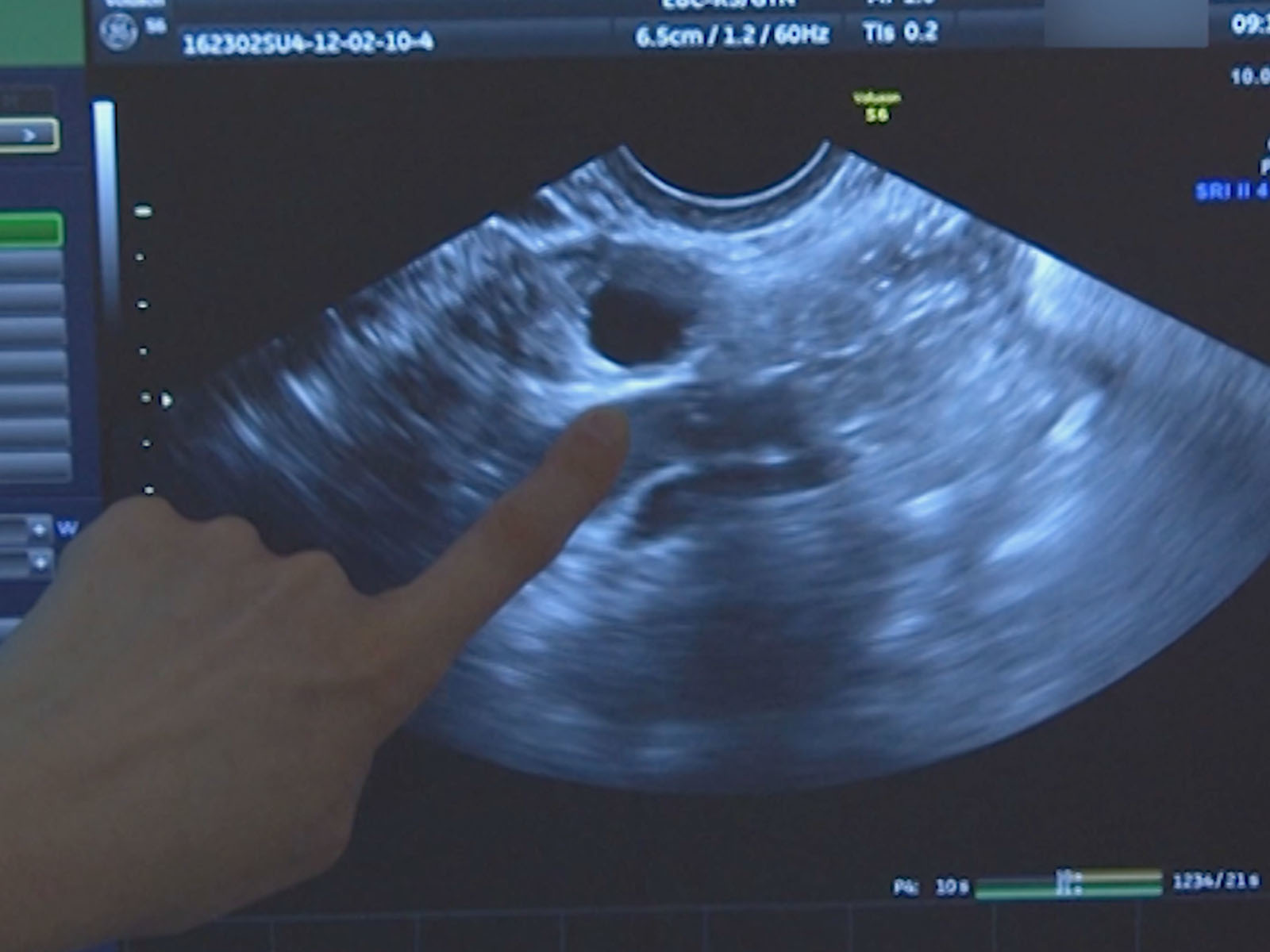 Prime Video: The Babymakers