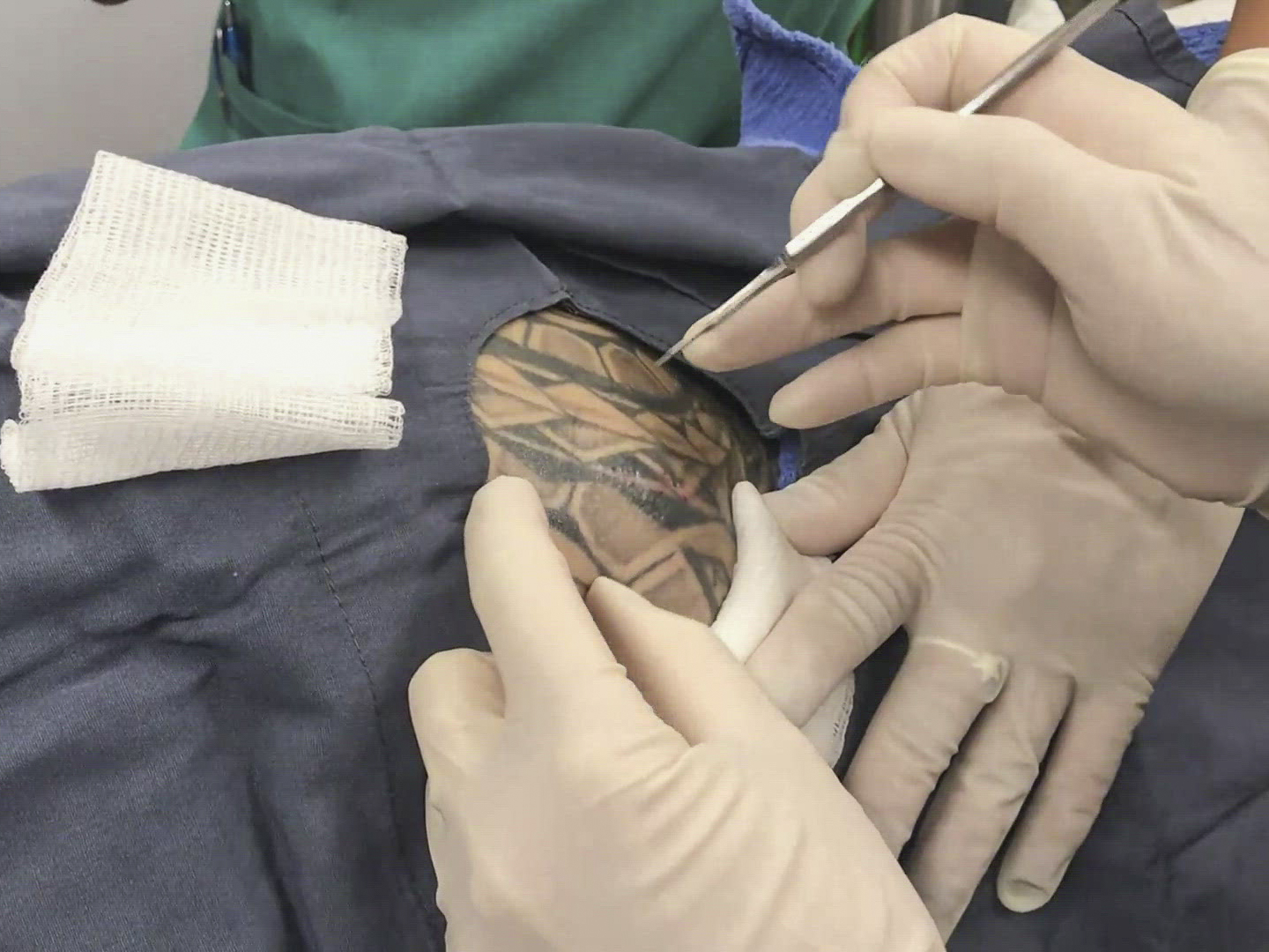 Prime Video: Dr. Pimple Popper: This is Zit - Season 8