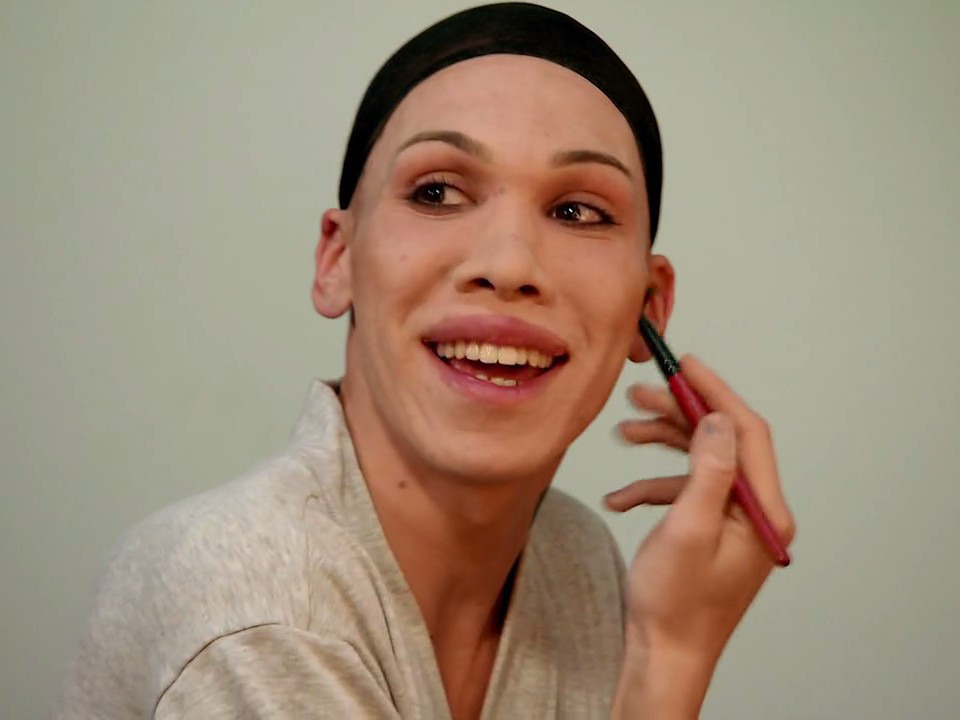 Prime Video: Botched Season 2