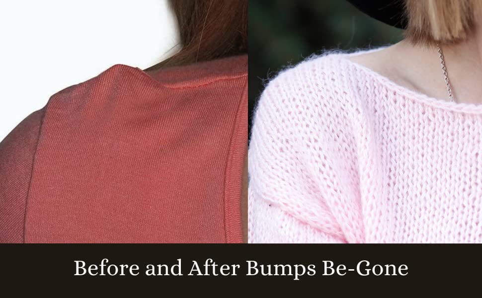 Amazon.com: Bumps Be-Gone